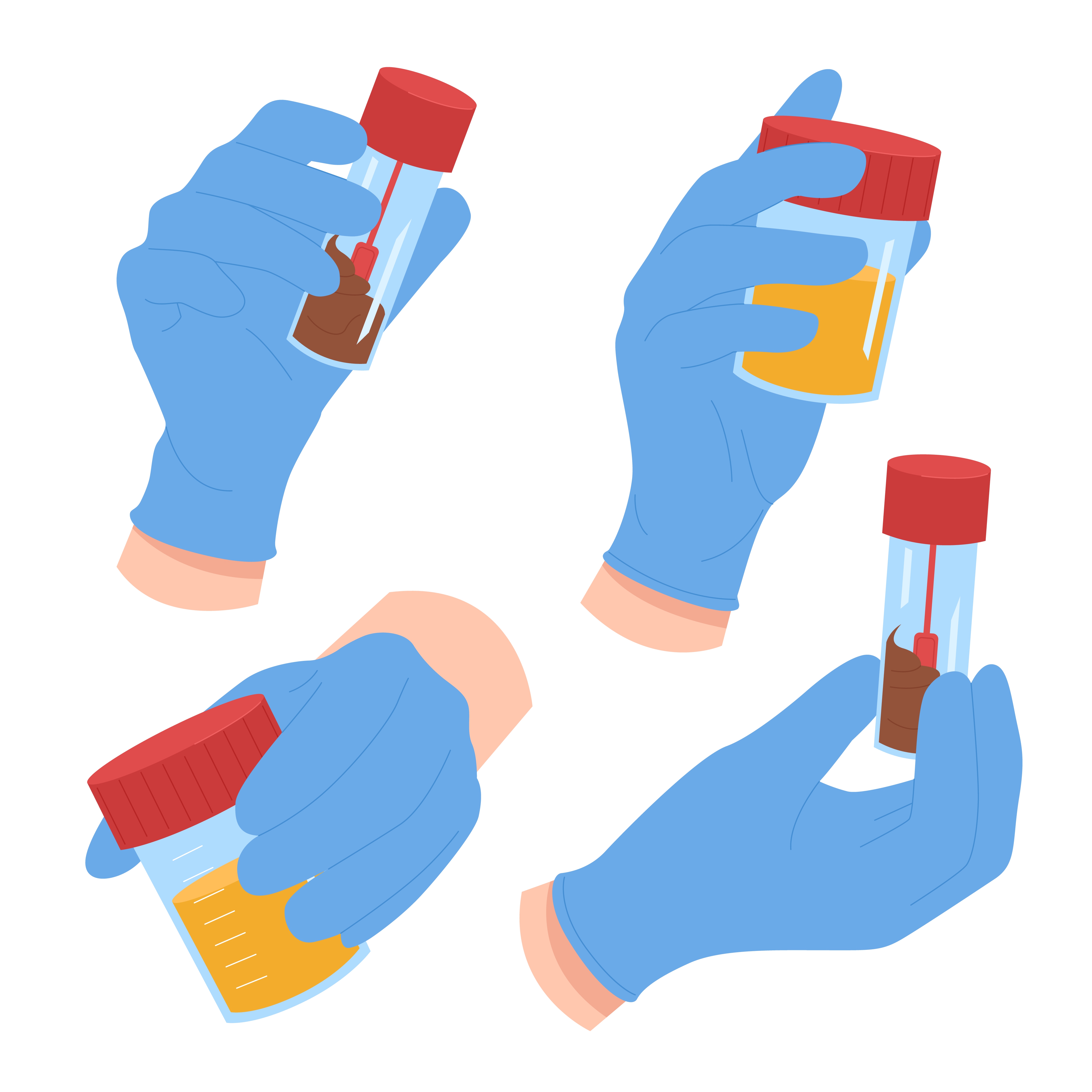 Ny analysemetode for kalprotektin - Helse Bergen HF