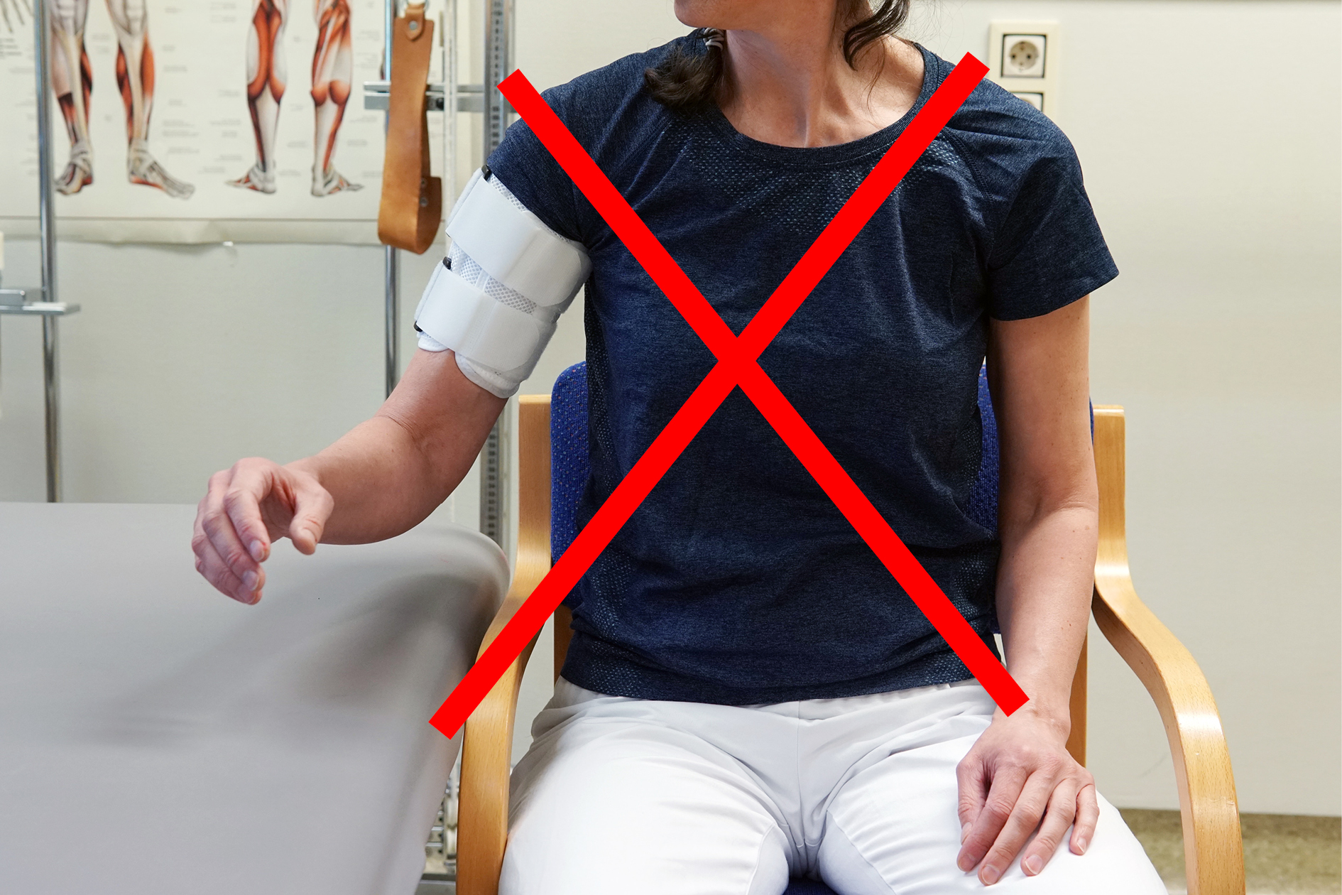 Brudd i overarm, behandling med ortose - Helse Bergen HF